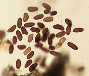 Figure 5.Spores released from pycnidia at 20x magnification.